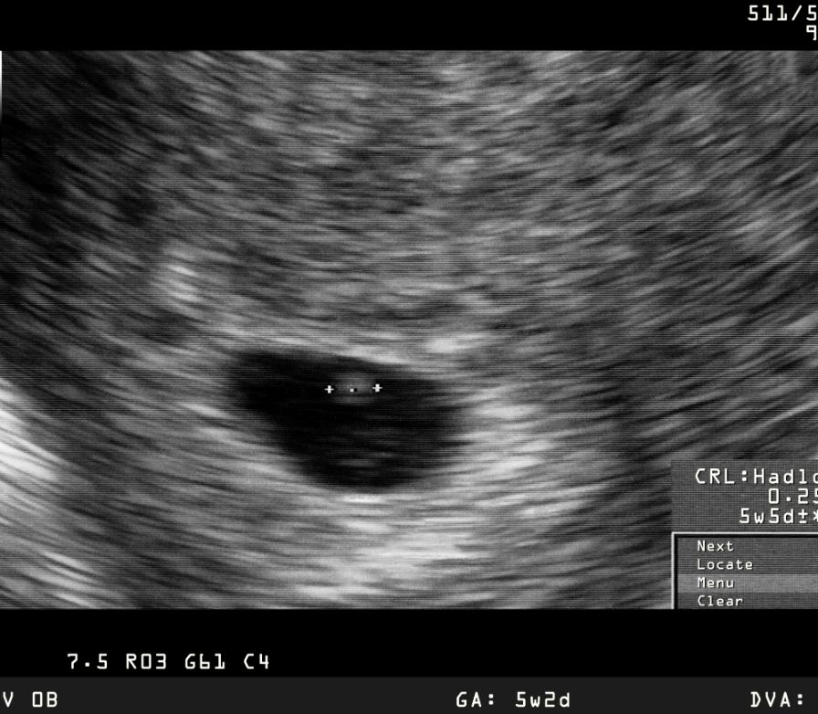 4. Schwangerschaftswoche: Baby & Mama | Famigros